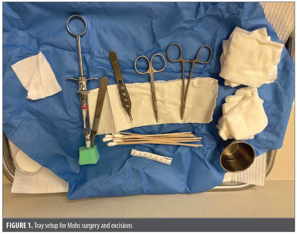 Optimizing Surgical Tray Setup and Instrument Selection in Dermatologic ...