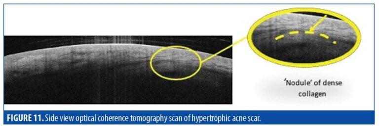 An Atlas of Optical Coherence Tomography (OCT): Elucidating In Vivo ...