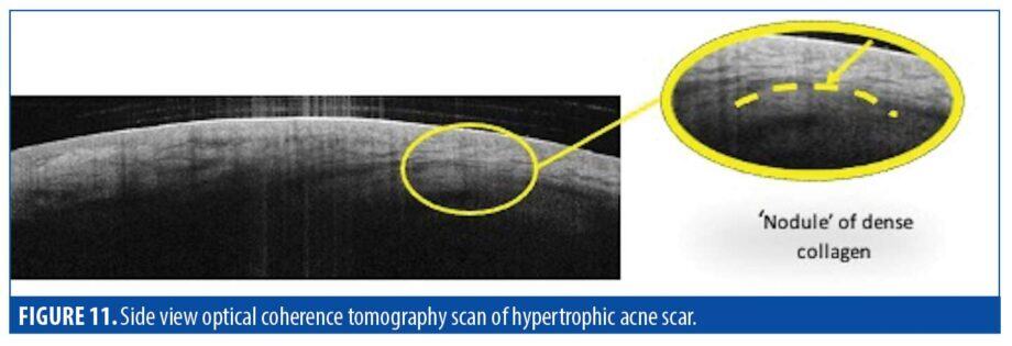 An Atlas of Optical Coherence Tomography (OCT): Elucidating In Vivo ...