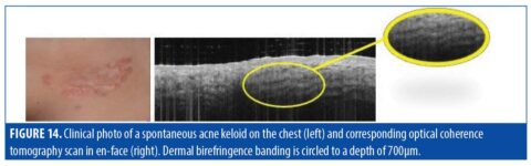 An Atlas of Optical Coherence Tomography (OCT): Elucidating In Vivo ...