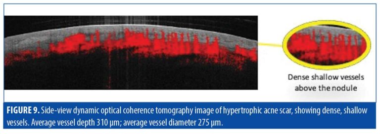 An Atlas of Optical Coherence Tomography (OCT): Elucidating In Vivo ...