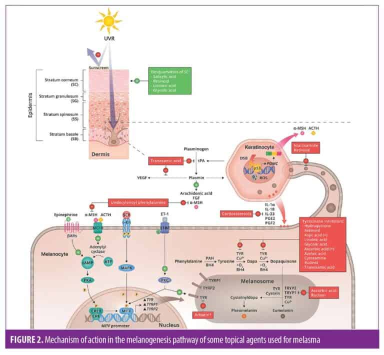 Topical Treatments for Melasma and Their Mechanism of Action | JCAD ...